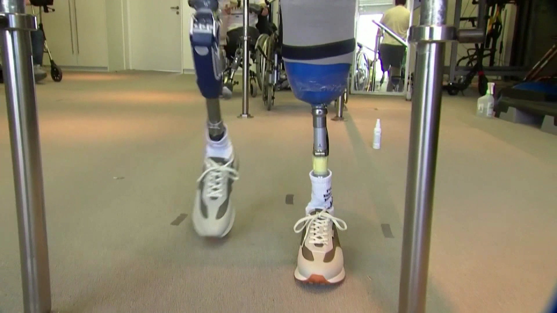 Agence Prothees: En neit Liewe mat Protheesen - RTL Lëtzebuerg